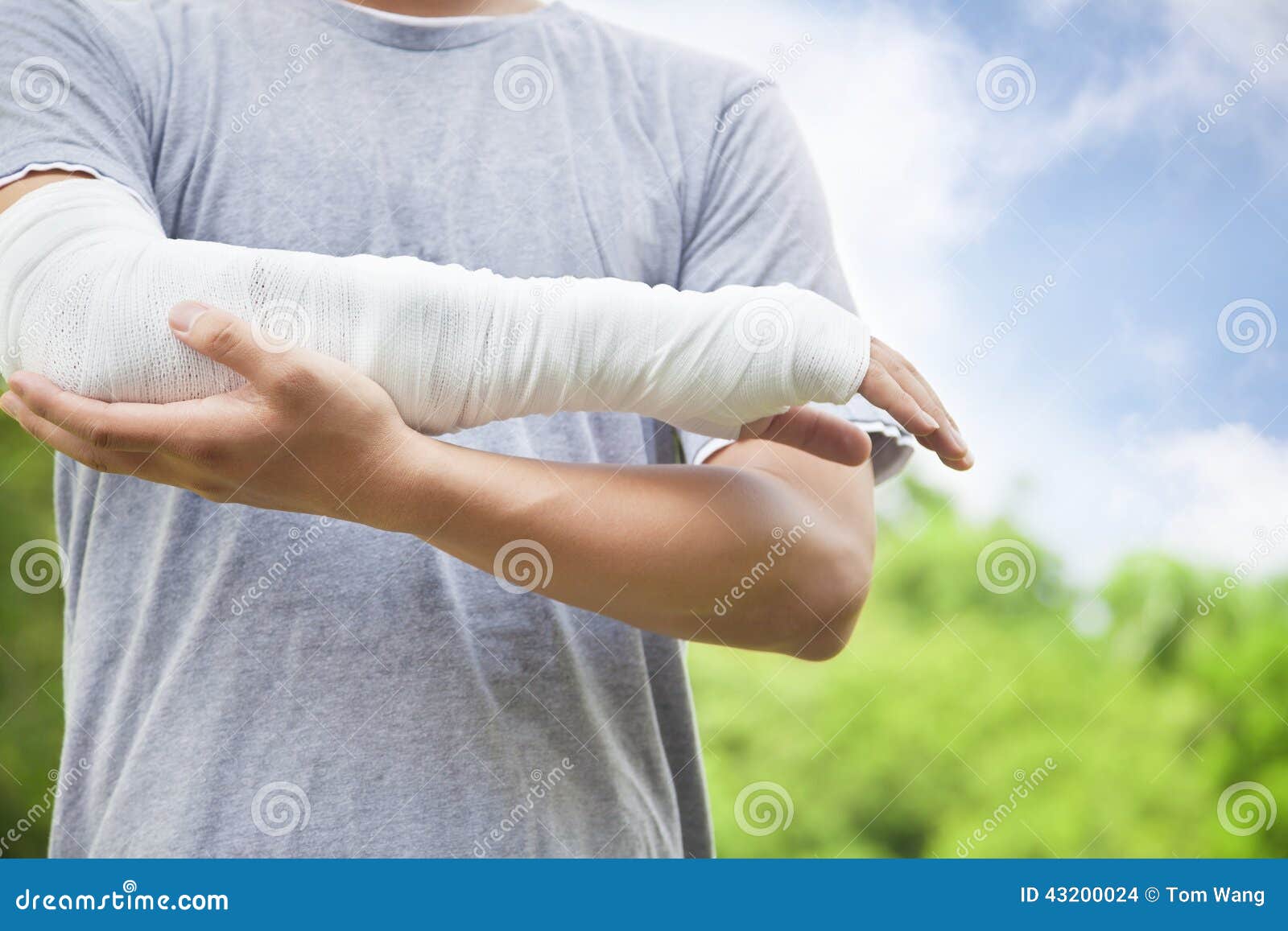 Closeup of Bandaged Arm in the Park Stock Photo - Image of medicare ...