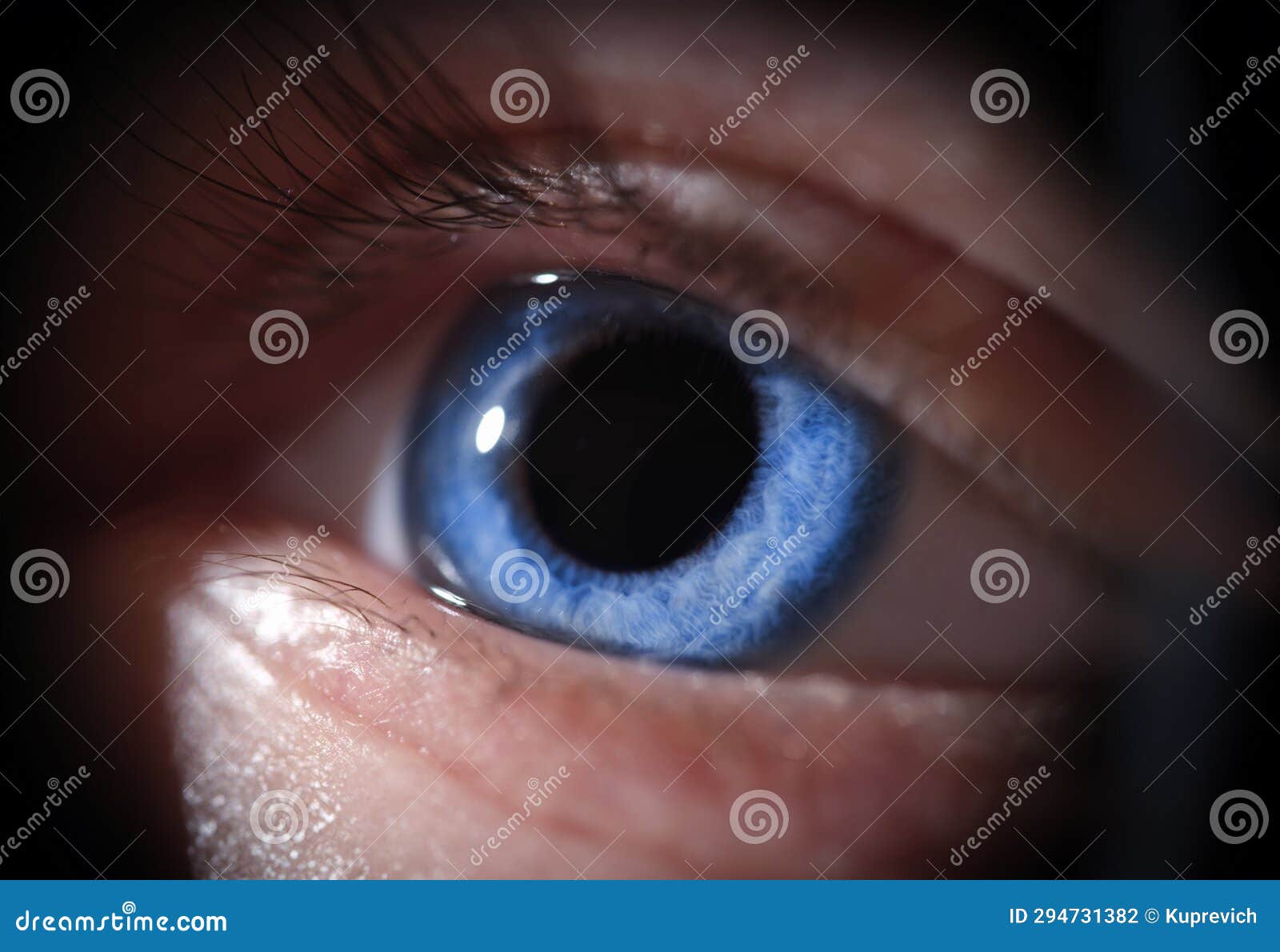 Closeup of Beautiful Bright Blue Human Eye Stock Photo - Image of ...