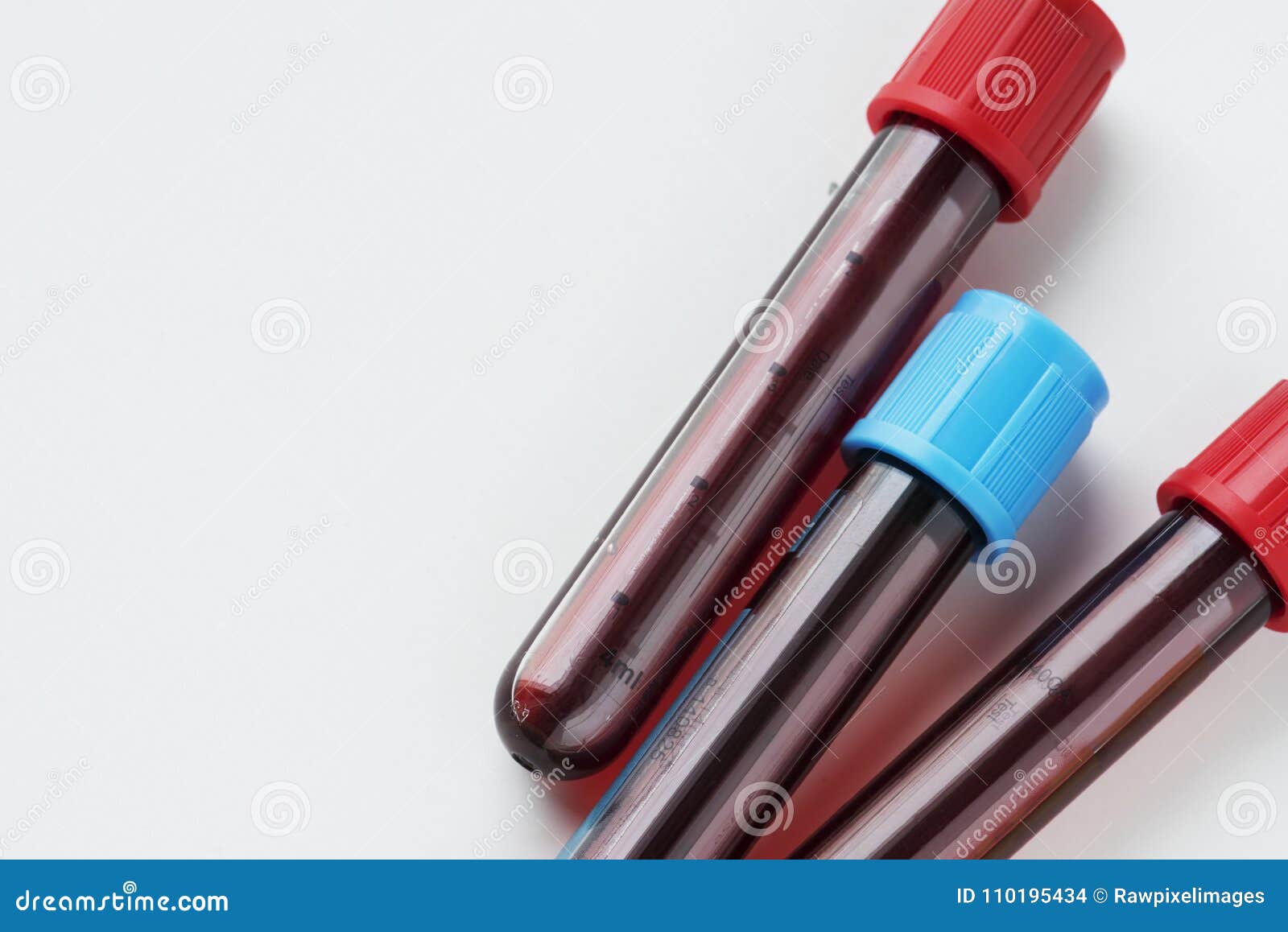 Closeup of blood tube test stock photo. Image of laboratory - 110195434