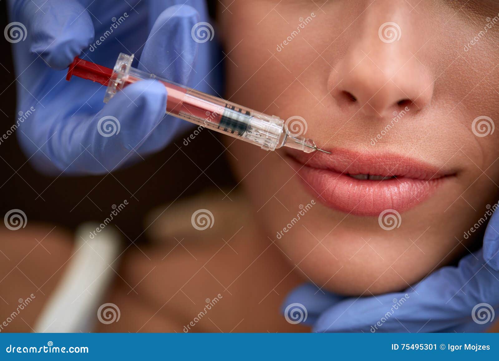 Closeup of botox injection stock image. Image of augmentation - 75495301