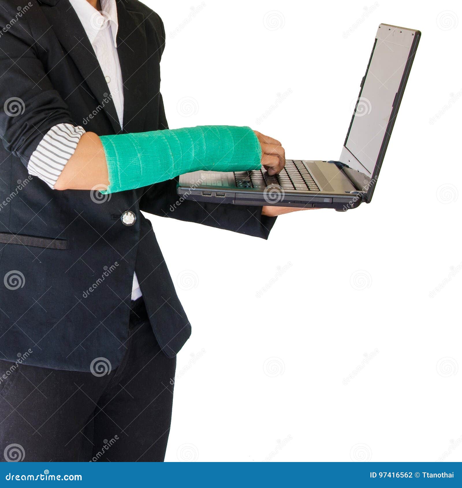 Closeup of a Broken Arm in a Cast and Using Laptop Computer on W Stock ...