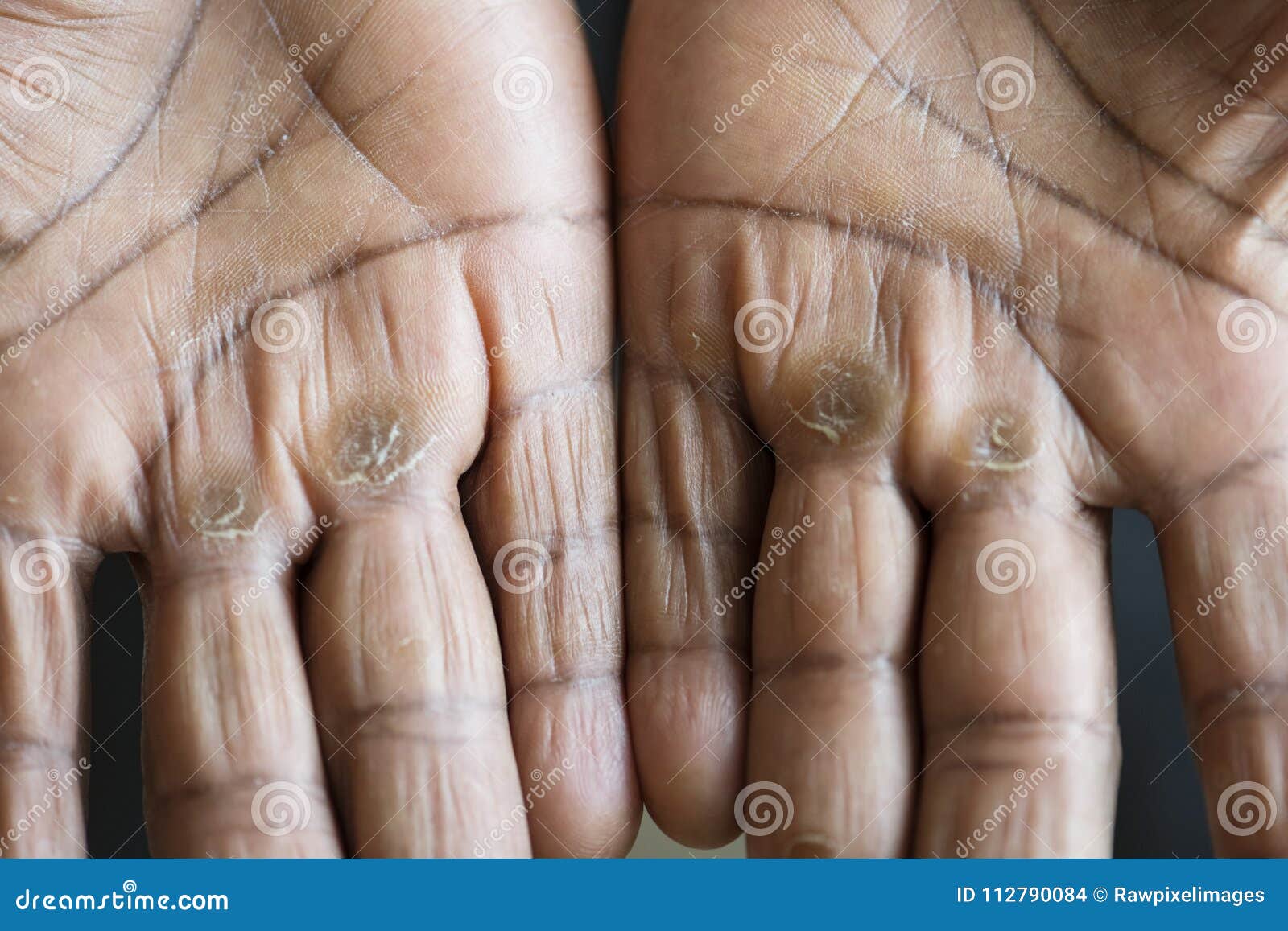 Closeup of Calloused Black Hands Stock Photo - Image of hands, hand ...