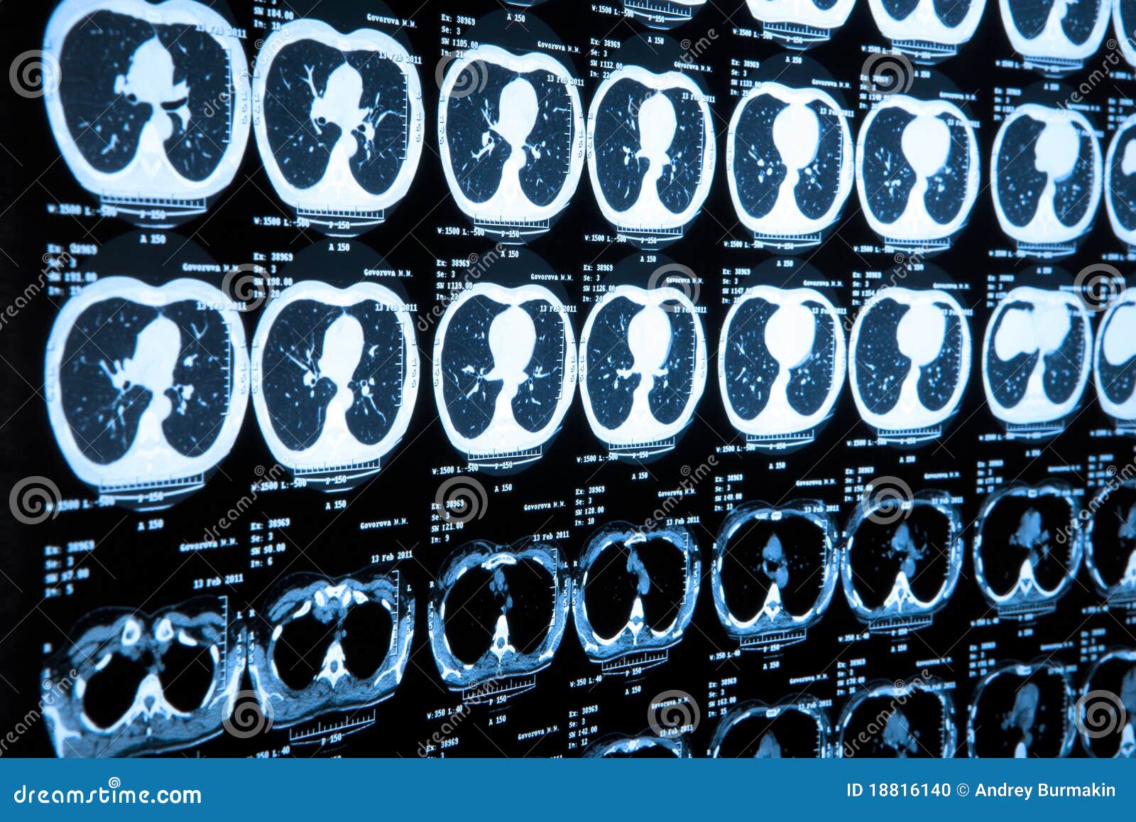 Closeup of a CT scan stock photo. Image of analysis, emission - 18816140