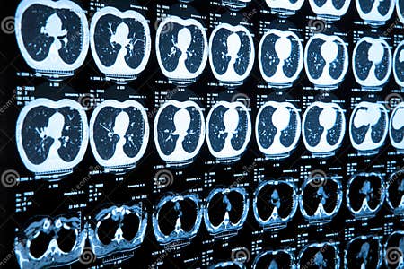 Closeup of a CT scan stock photo. Image of analysis, emission - 18816140