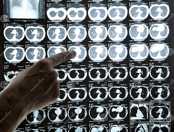 Closeup of a CT scan stock photo. Image of emission, analysis - 18816196