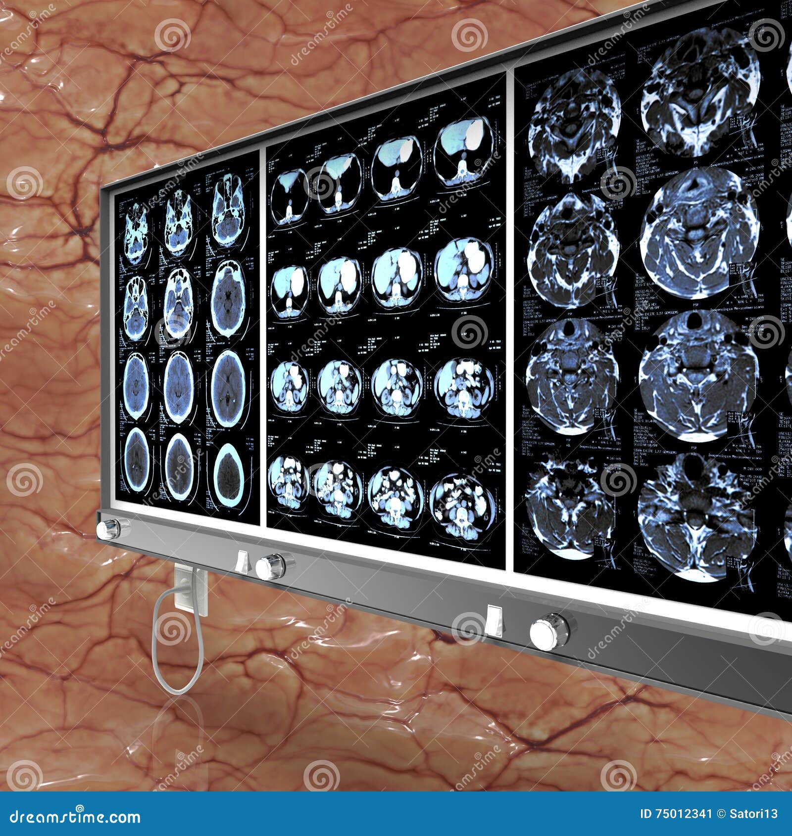 Closeup of a CT Scan with Brain 3d Illustration Stock Image - Image of ...