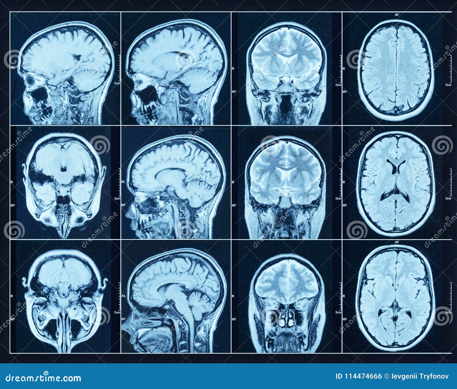 Closeup of a CT Scan with Brain. Science and Education Mri Background ...