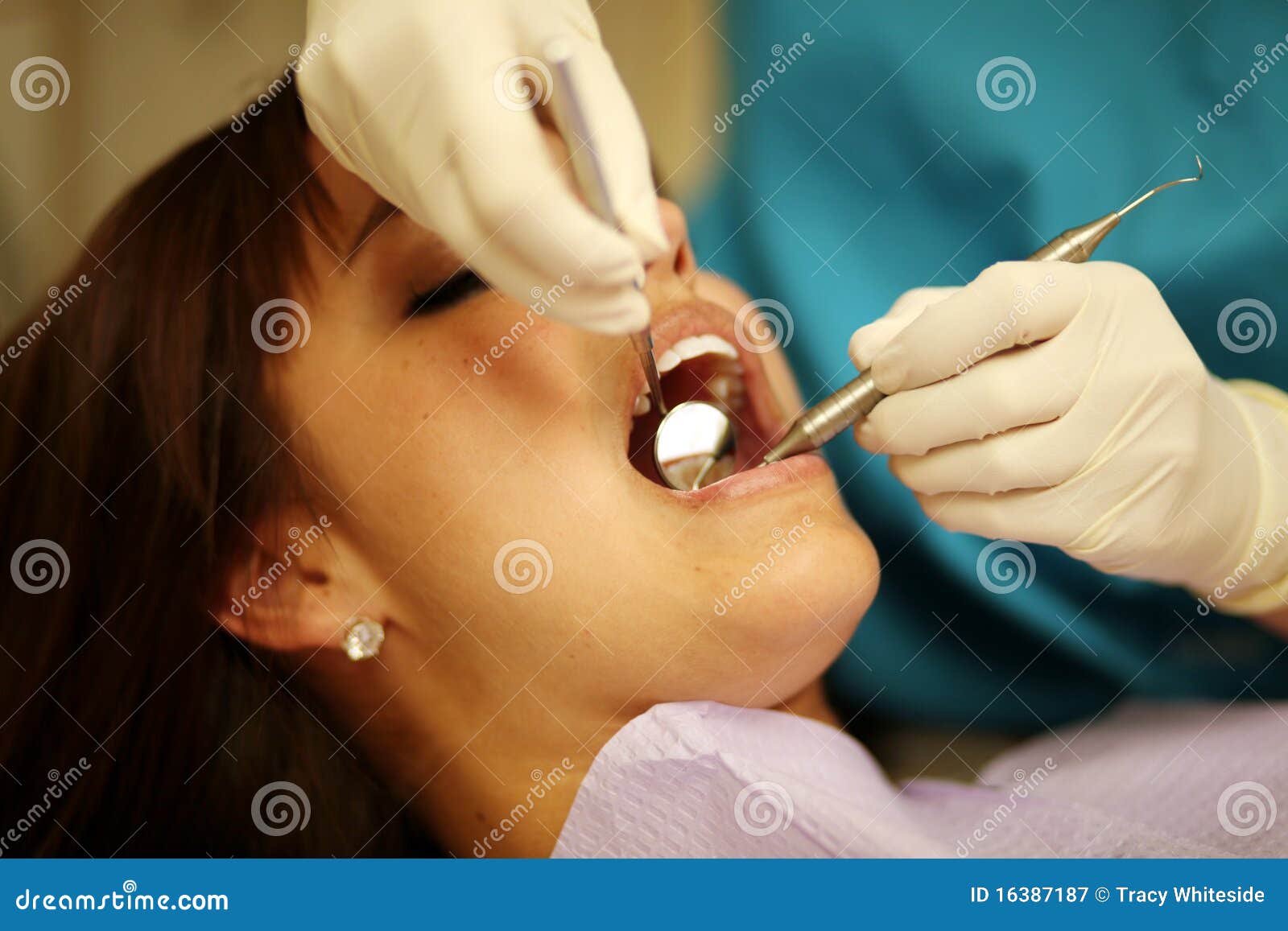 Closeup of Dental Patient Exam Stock Image - Image of office, care ...
