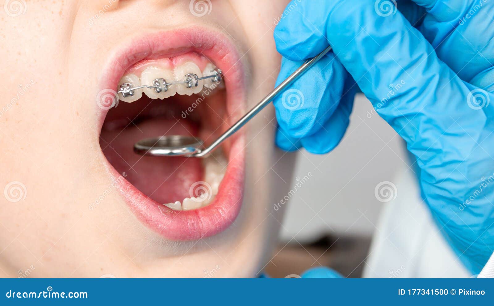 Dentist Using an Instrument To Visualize the Teeth of a Child Patient ...
