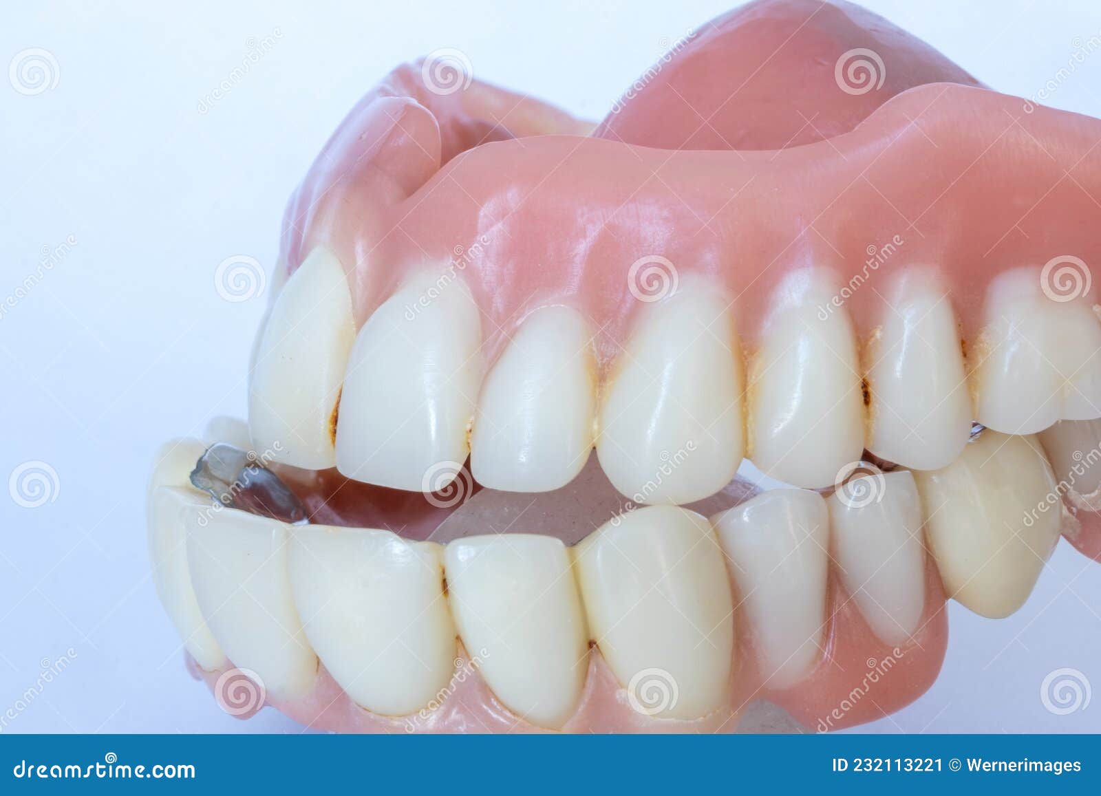 Closeup of Denture on a White Background Stock Image - Image of tooth ...