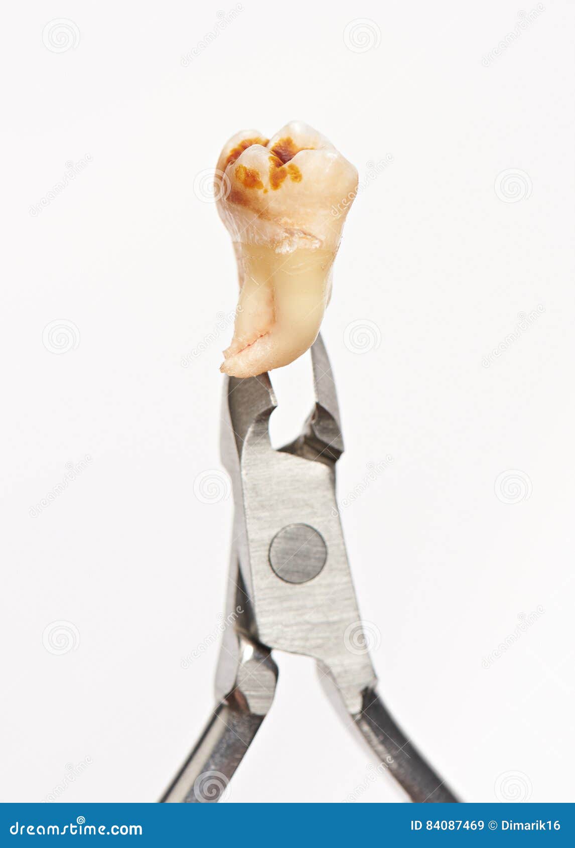 Closeup of extracted teeth stock image. Image of cavities - 84087469