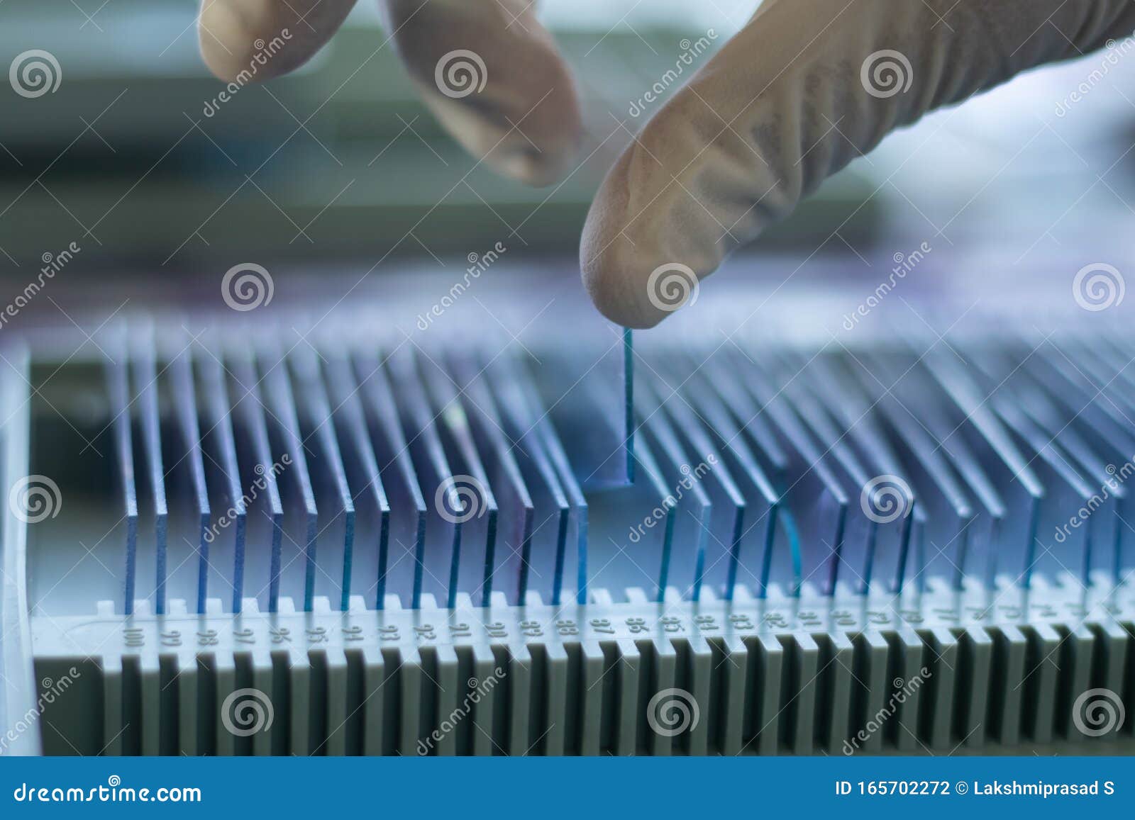 Closeup of Hands Checking Blood Testing Glass Slide from the Archive or ...