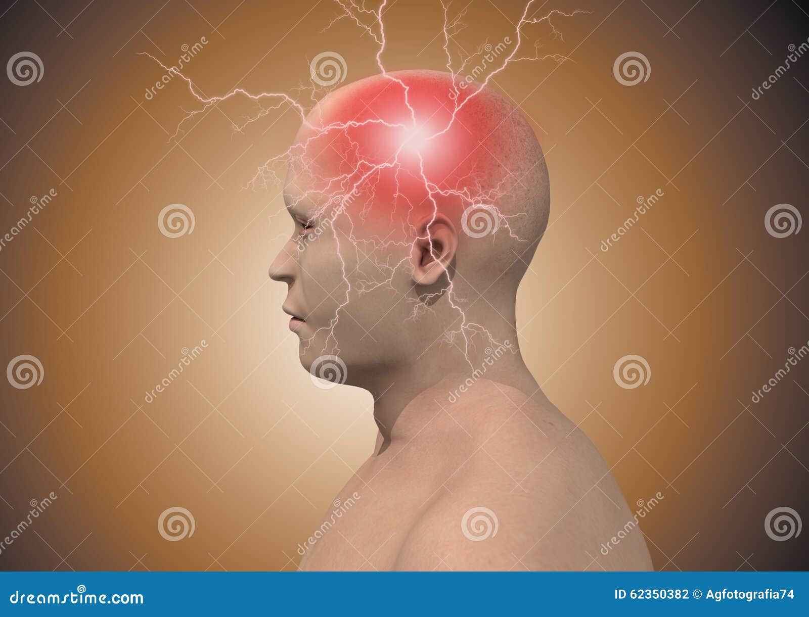 Closeup head stock illustration. Illustration of migraine - 62350382