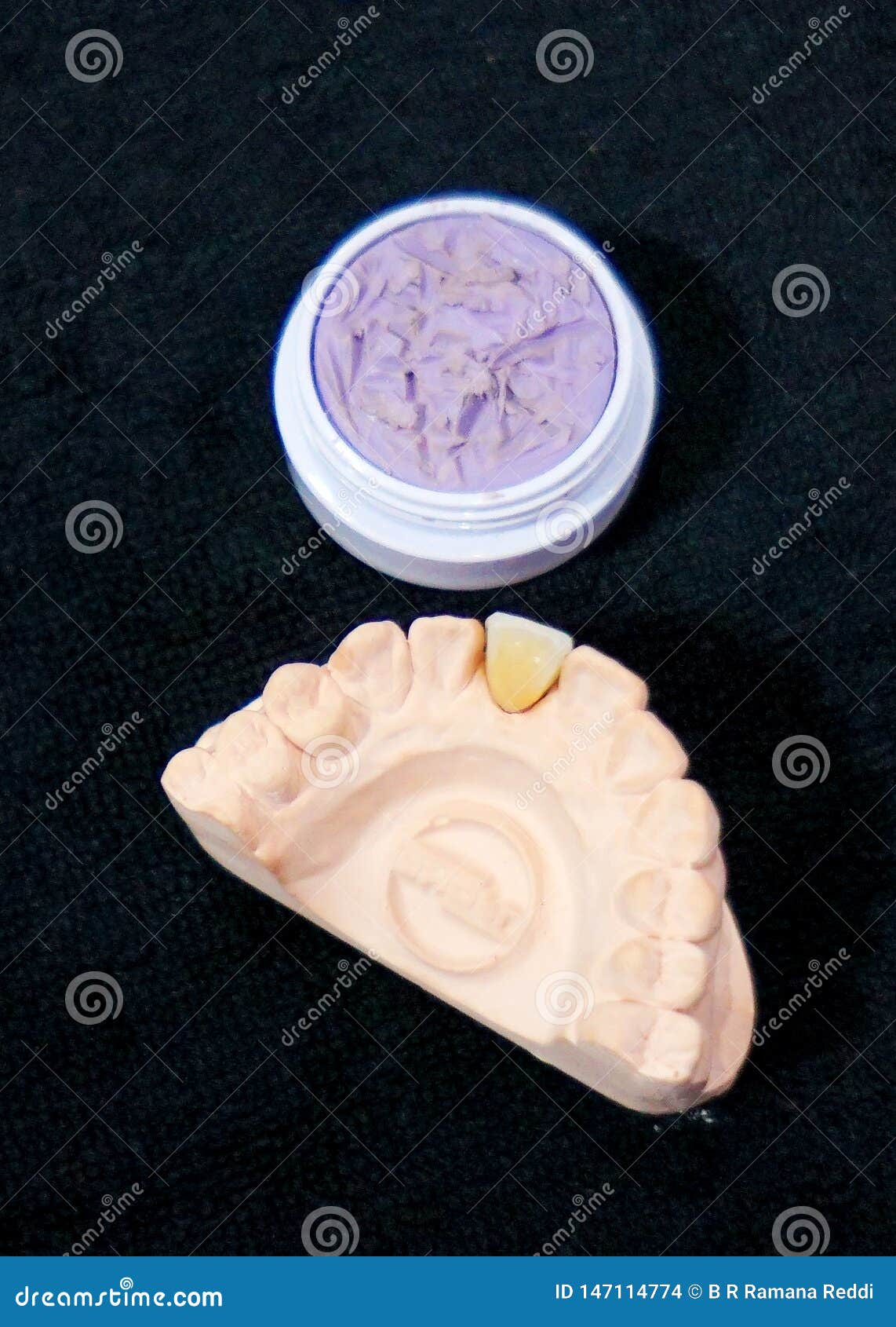 Closeup of Human Upper Jaw Denture Mold Stock Photo - Image of form ...