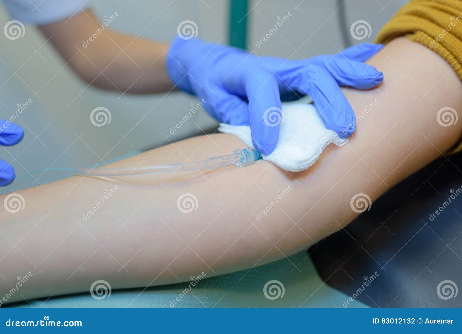 Closeup Intravenous Drip in Arm Stock Photo - Image of procedure, work ...