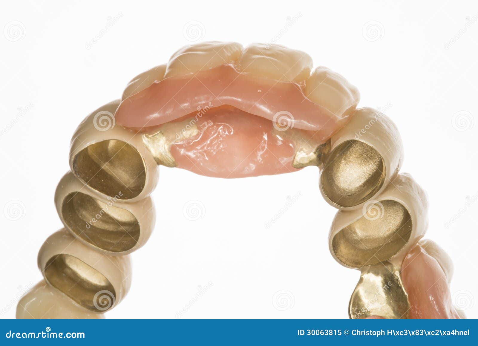 Dental prothesis stock image. Image of surgeon, telescope - 30063815