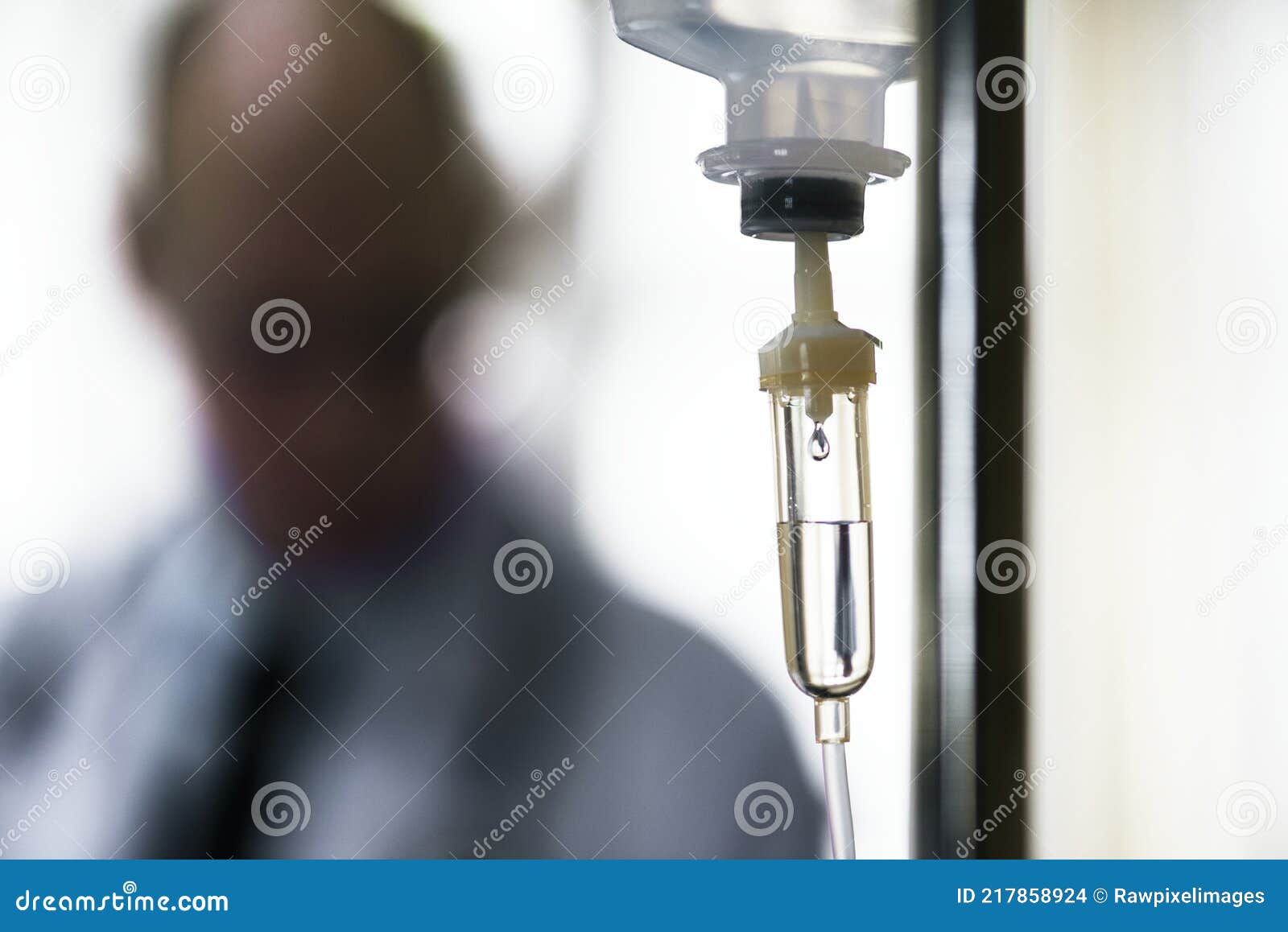 Closeup of IV drip chamber stock photo. Image of therapy - 217858924