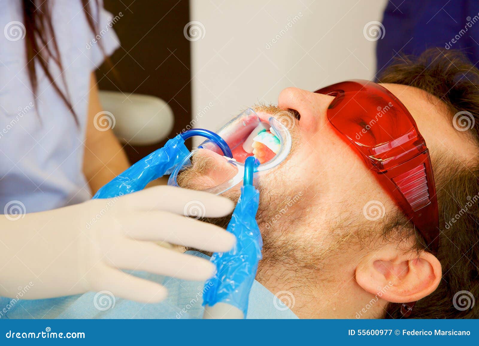 Closeup of Man Getting Teeth Whitening Stock Image - Image of mouth ...