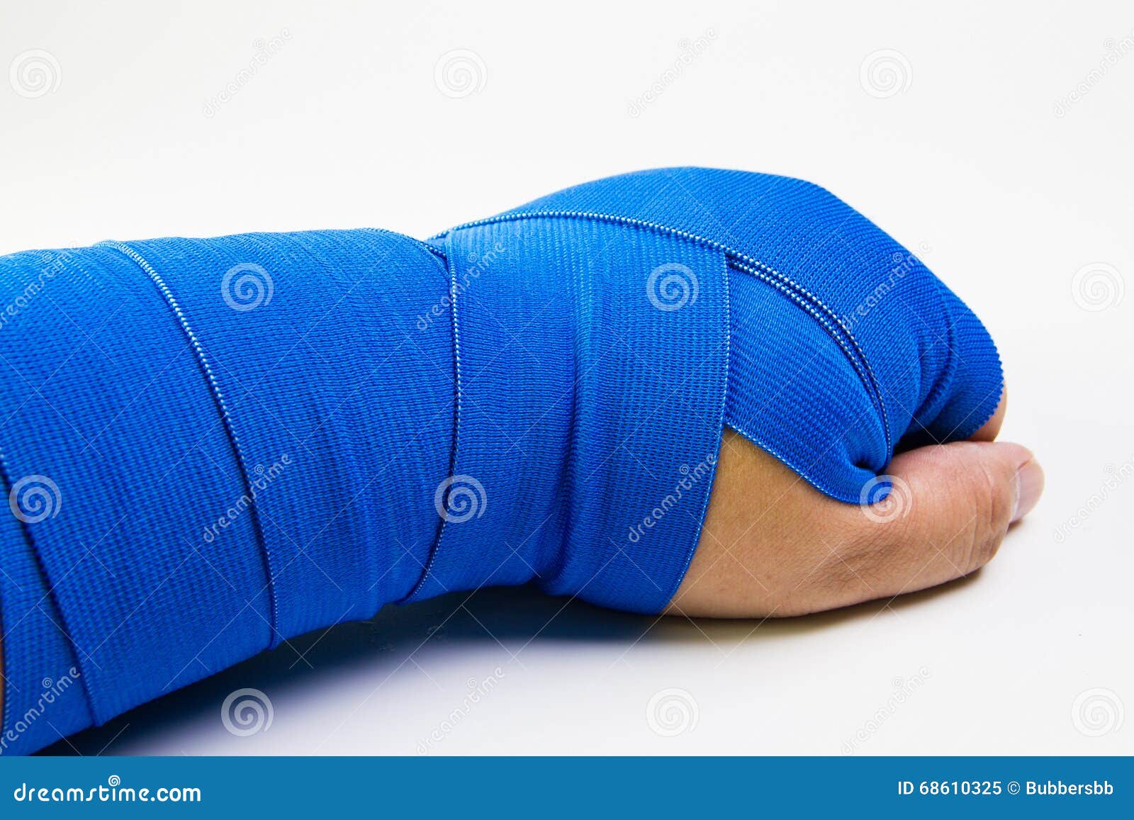 A Closeup of a Man with a Hurt Bandaged Arm. Stock Image - Image of ...