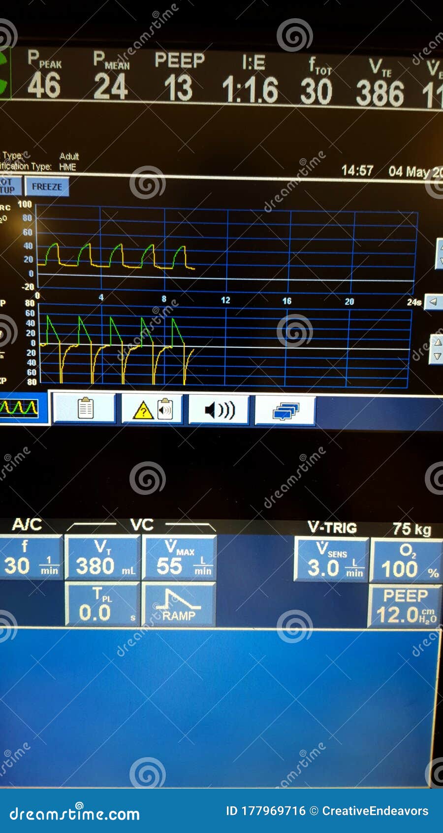 Mechanical Ventilator Screen