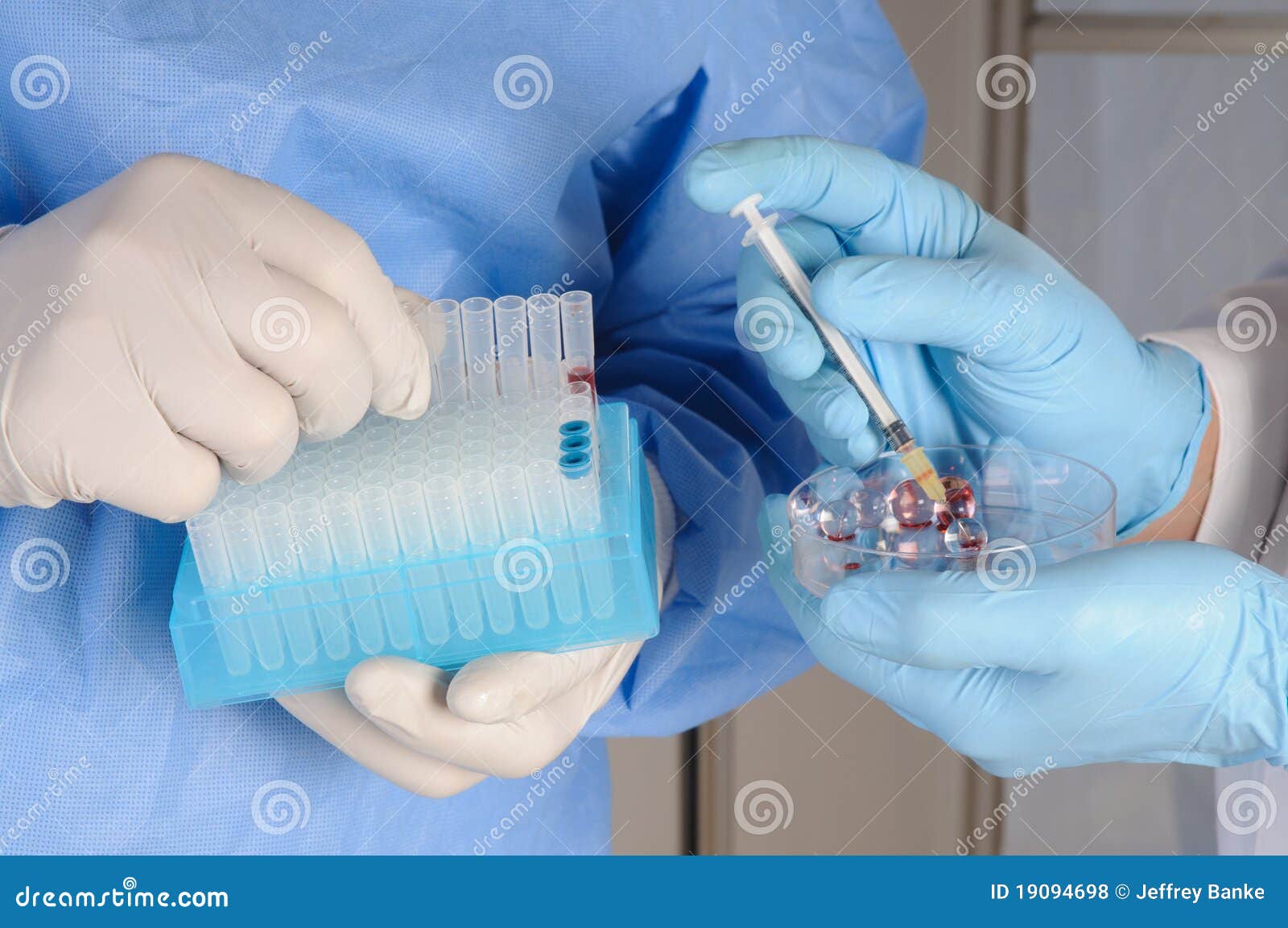 Closeup of Medical Analysis Stock Photo - Image of plasma, glasses ...