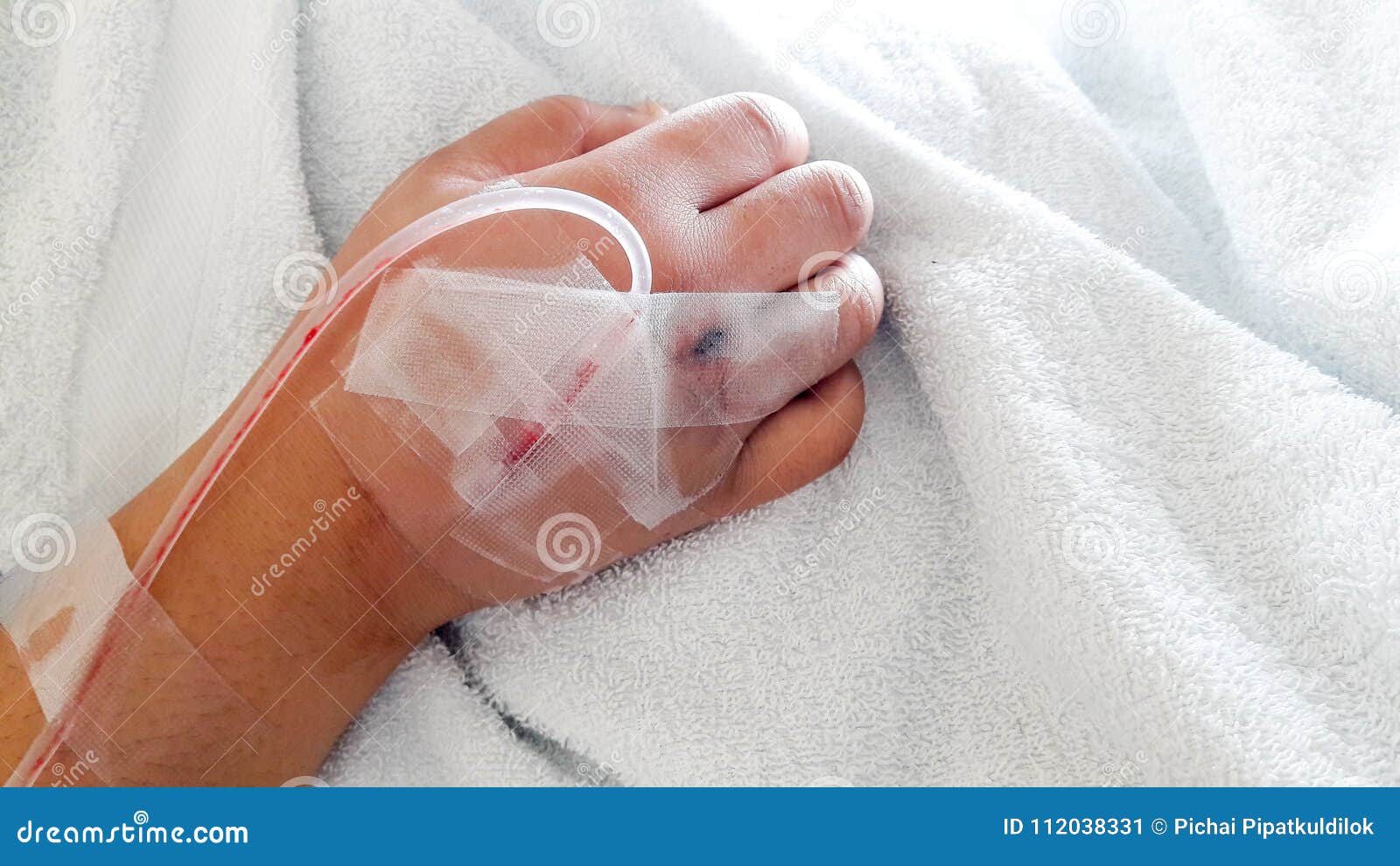 Closeup Saline Water Line on a Hand Stock Image - Image of medicine ...