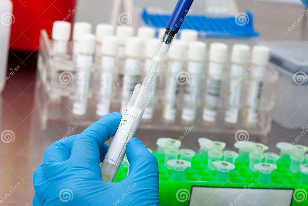 Closeup of a Scientist Extracting DNA Using the Spin Column-based ...