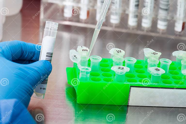 Closeup of a Scientist Extracting DNA Using the Spin Column-based ...