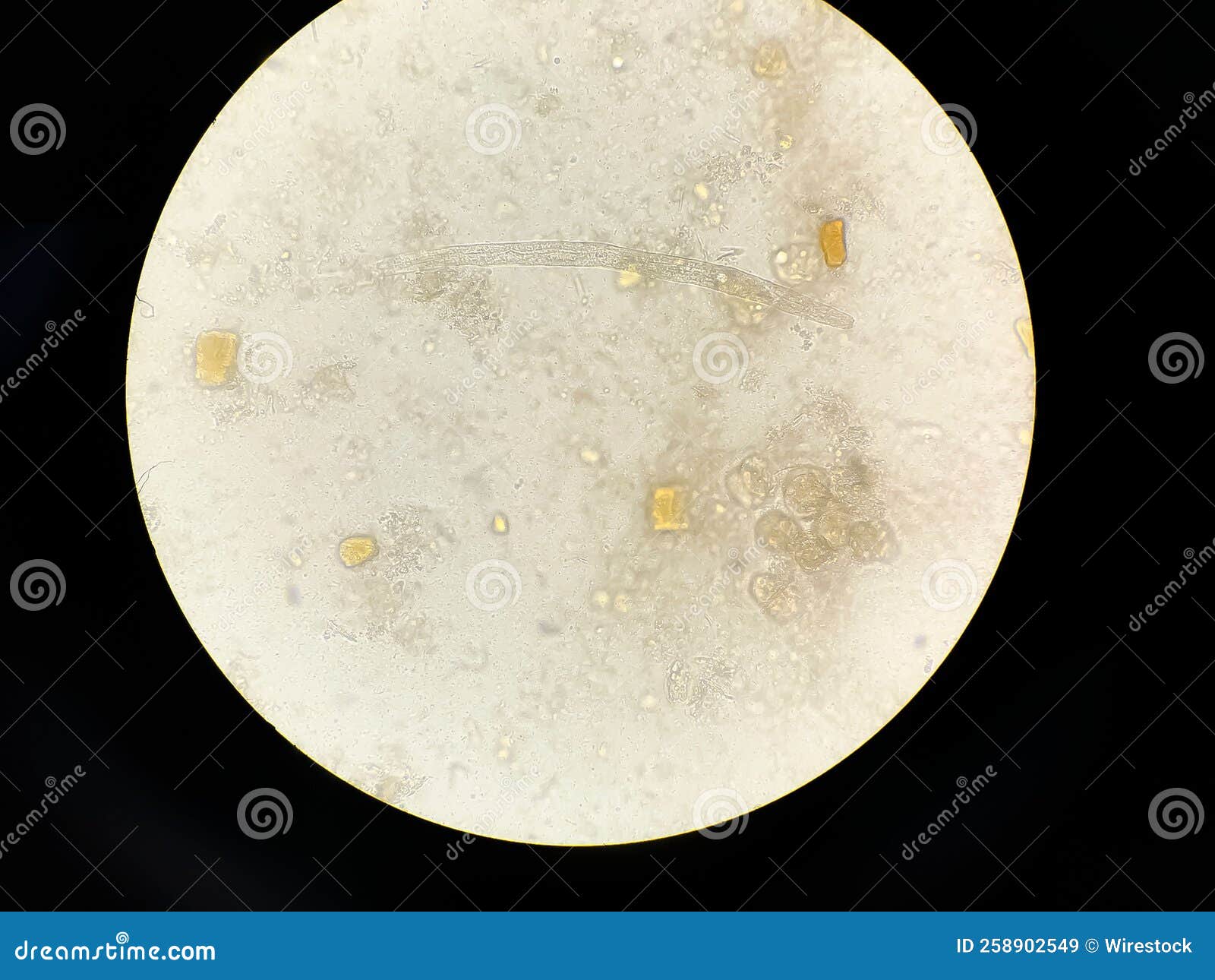 Closeup shot of a parasite stock image. Image of abstract - 258902549