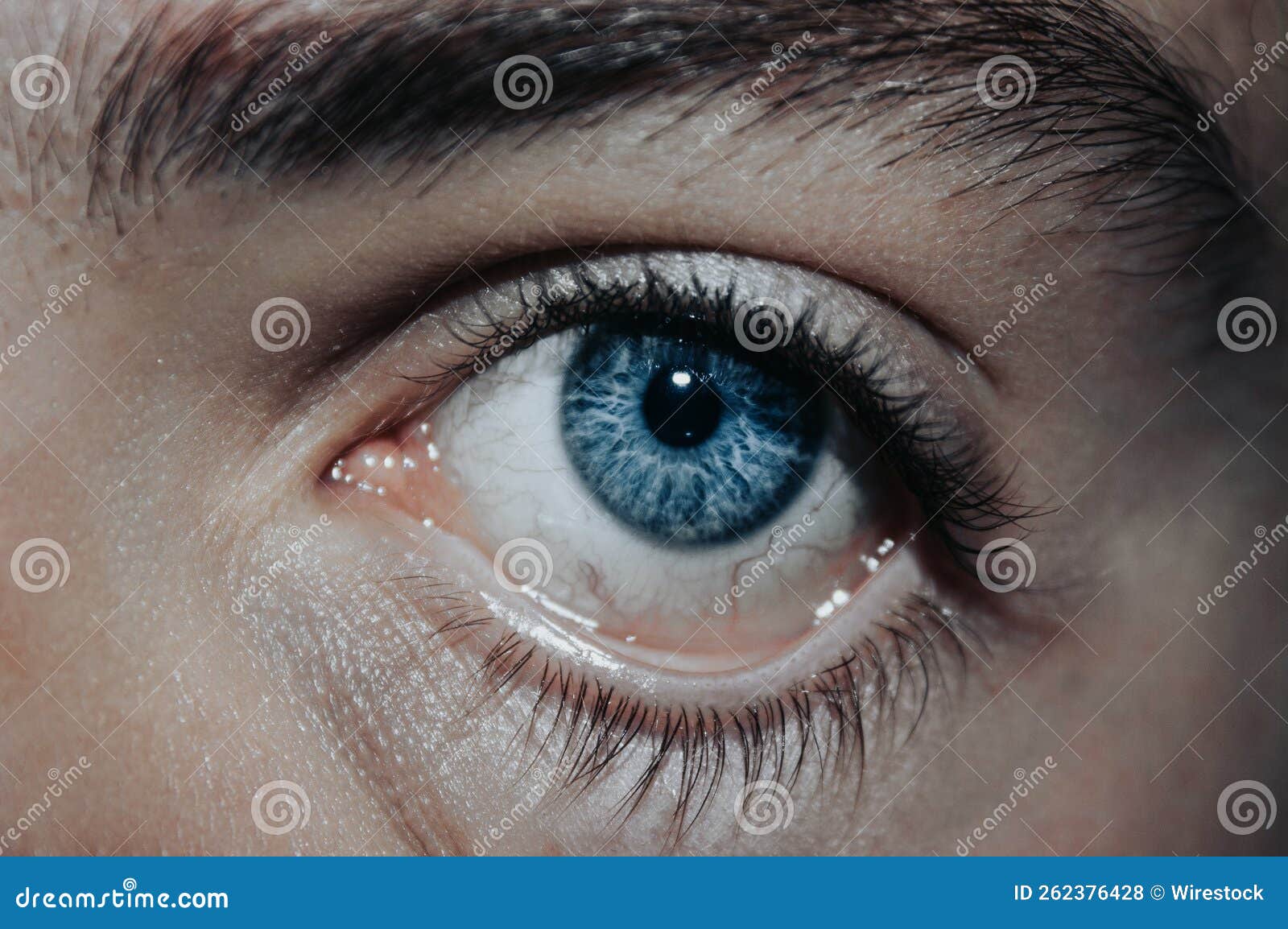 Closeup Shot of a Pulled Down Blue Human Eye with Veins, Ophtalmology ...