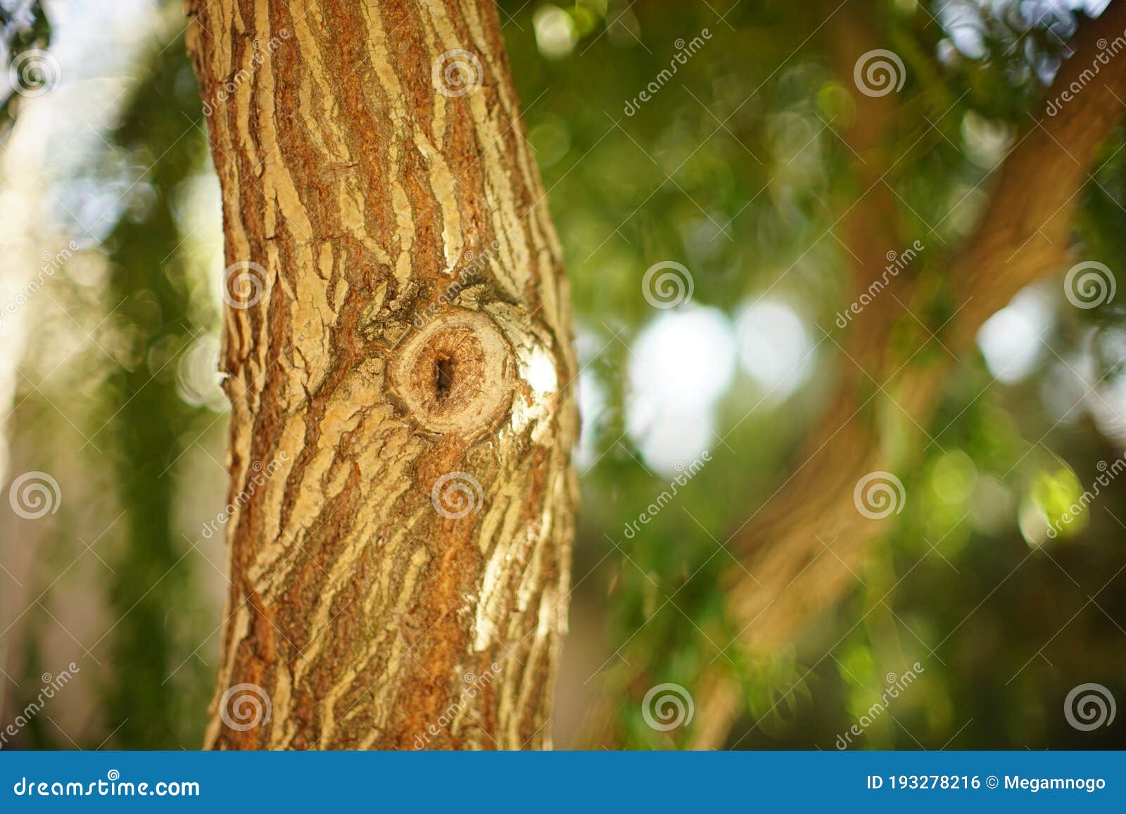Closeup Of Weeping Wound, Thermal Burn, Trophic Ulcer On Female Leg ...