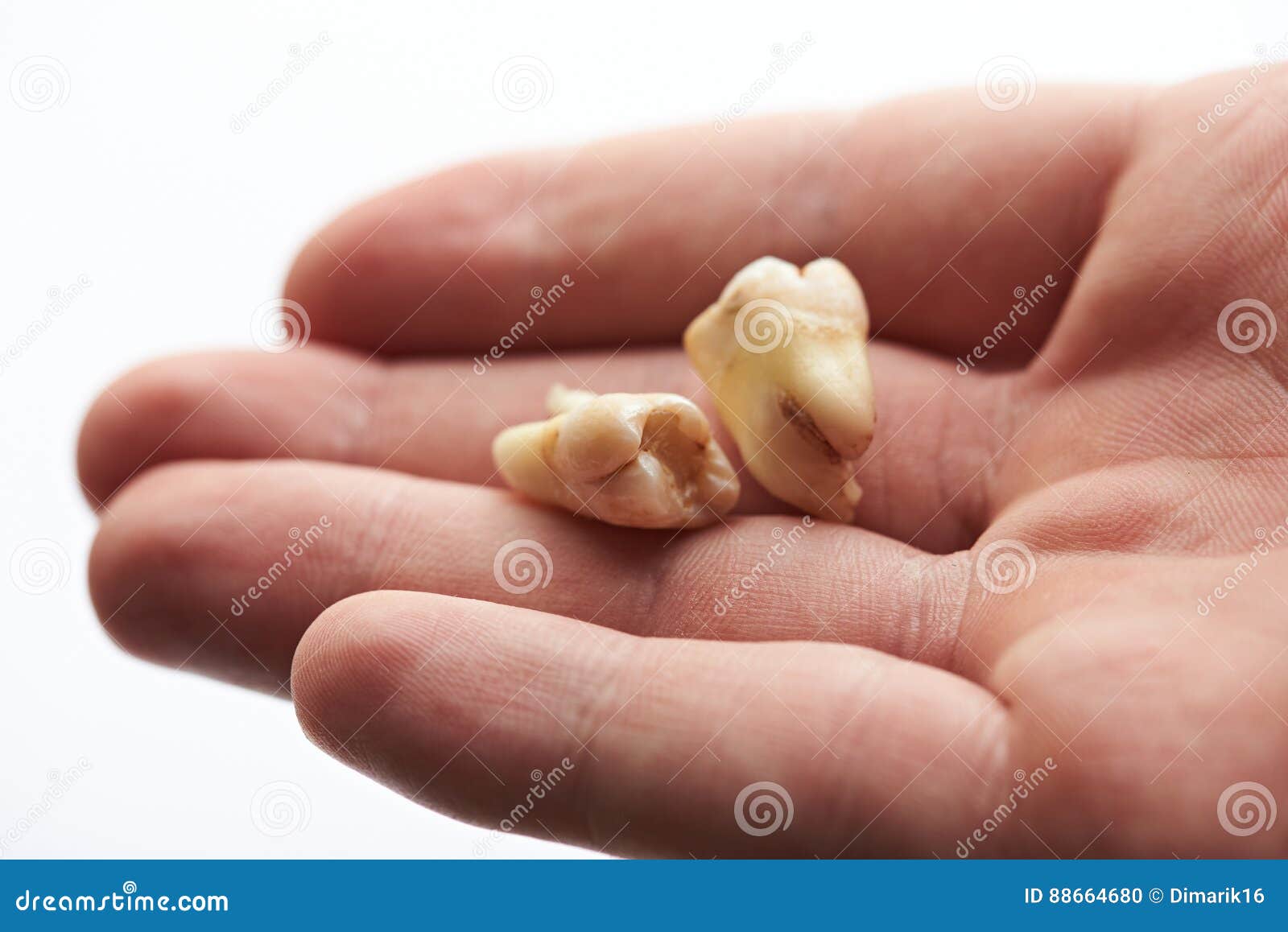 Closeup of two tooth stock photo. Image of attractive - 88664680