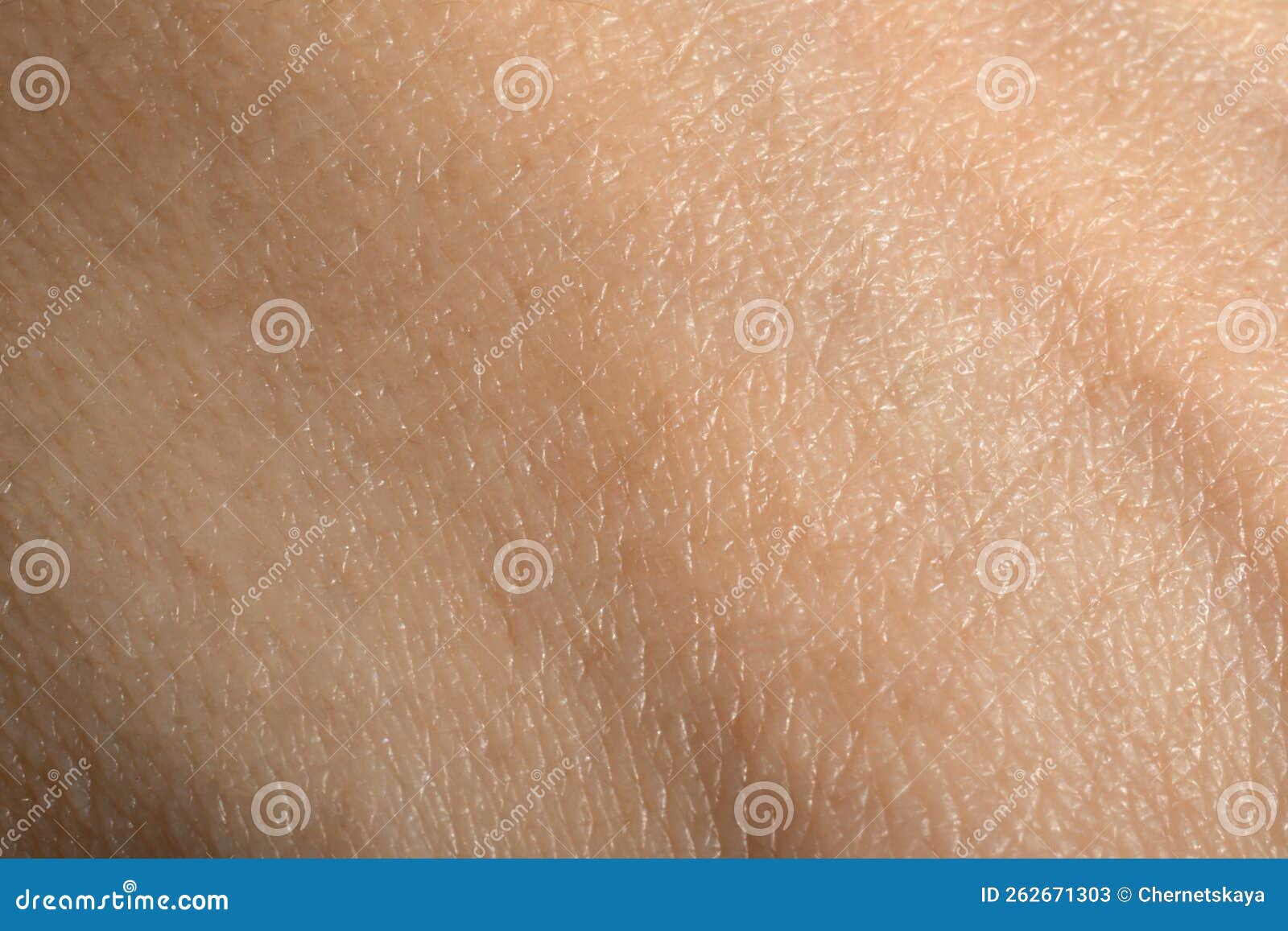 Closeup View of Dry Human Skin As Background Stock Image - Image of ...