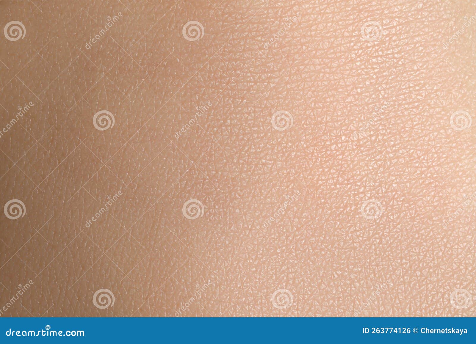 Closeup View of Dry Human Skin As Background Stock Photo - Image of ...