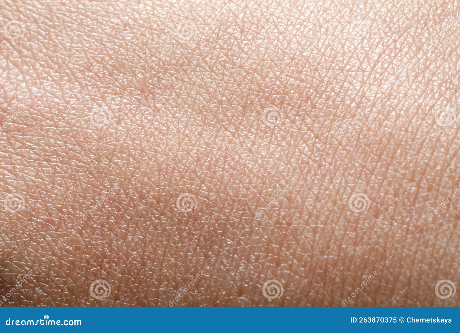 Closeup View of Dry Human Skin As Background Stock Image - Image of ...