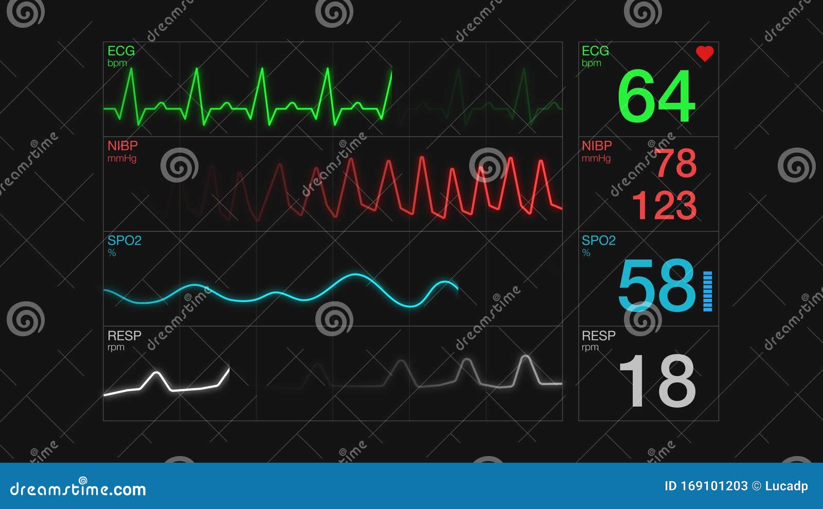 Ecg Ekg Screen Royalty-Free Stock Photography | CartoonDealer.com ...