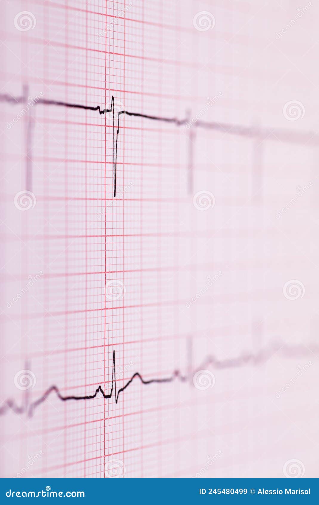 ECG Graph. Electrocardiograph Stock Image - Image of healthcare ...