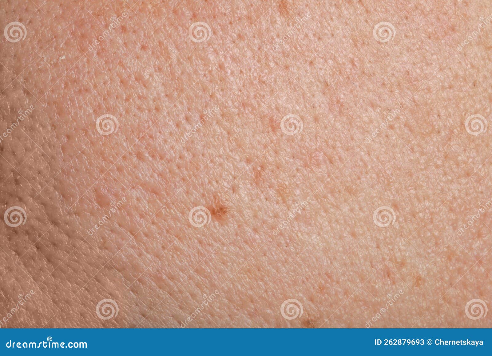 Closeup View of Human Skin As Background Stock Image - Image of ...