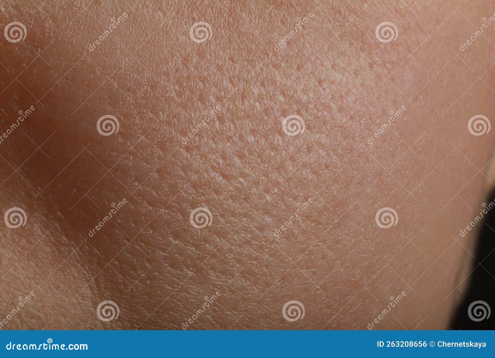 Closeup View of Human Skin As Background Stock Photo - Image of effect ...