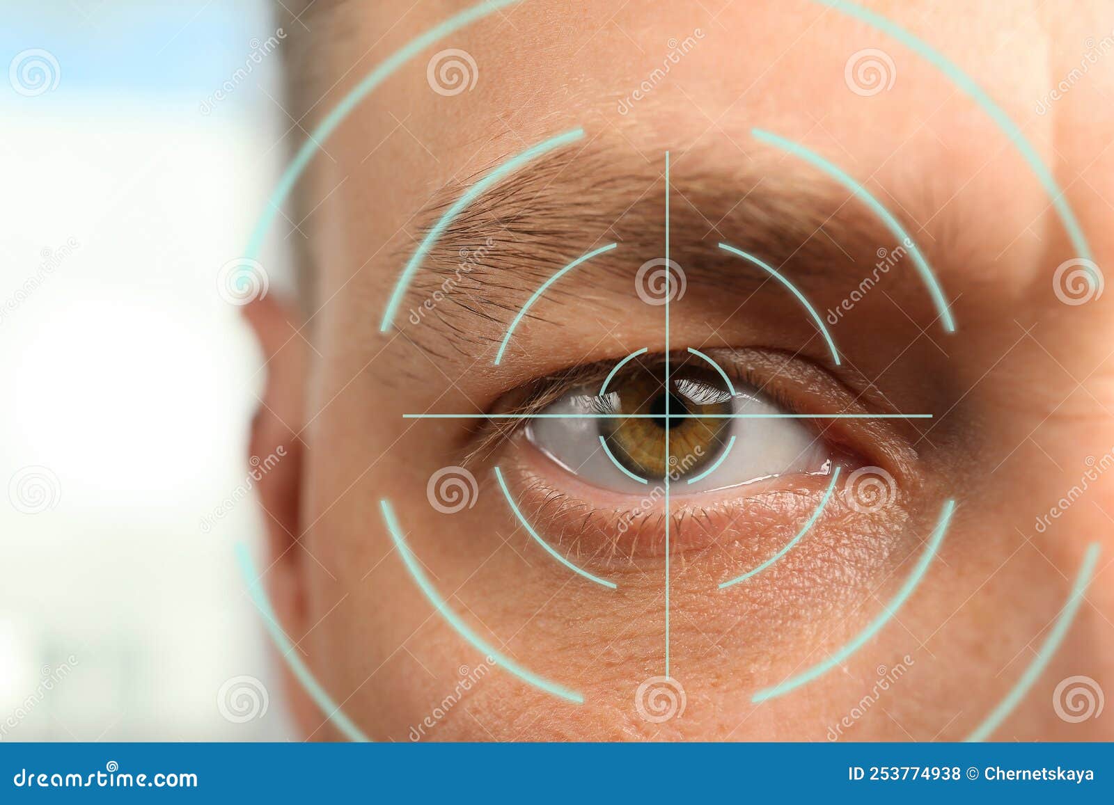 Closeup View of Man and Mark Illustration on His Eye. Vision Correction ...