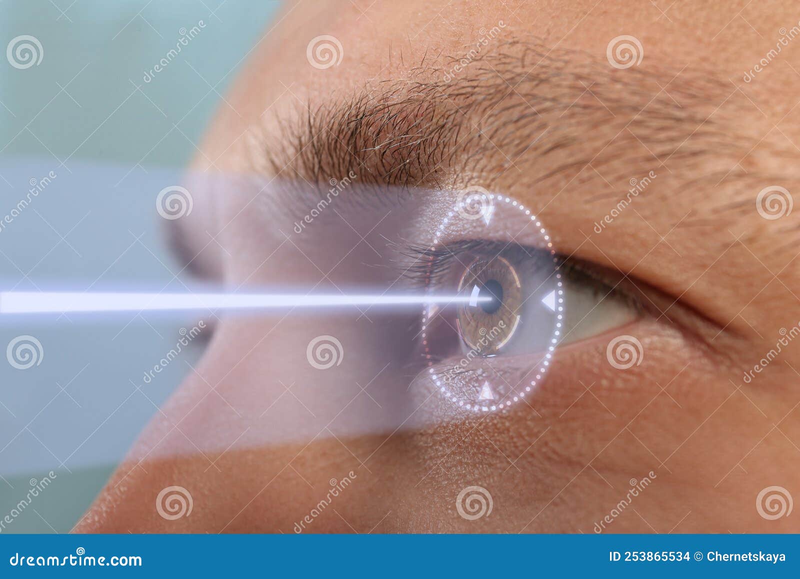 Closeup View of Man and Mark Illustration on His Eye. Vision Correction ...