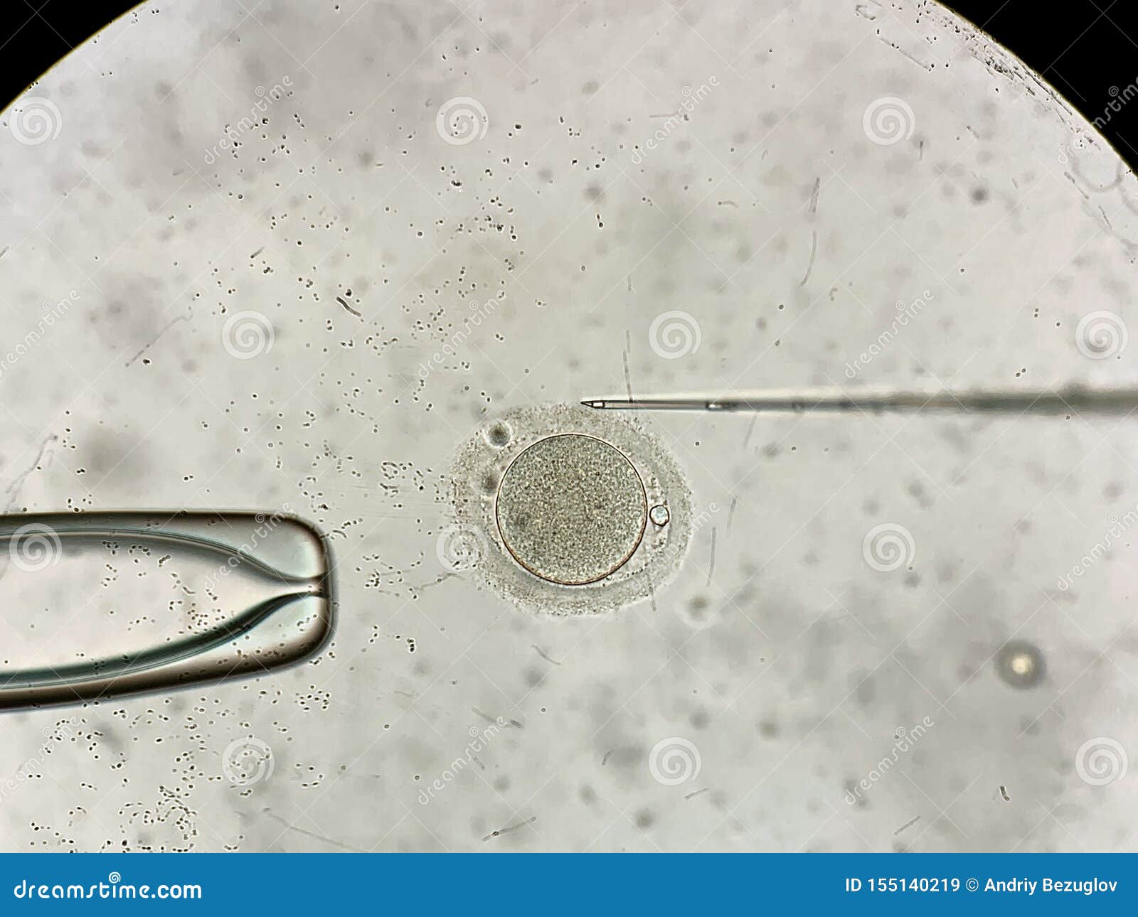 View through Microscope at in Vitro Fertilization Process Stock Image ...