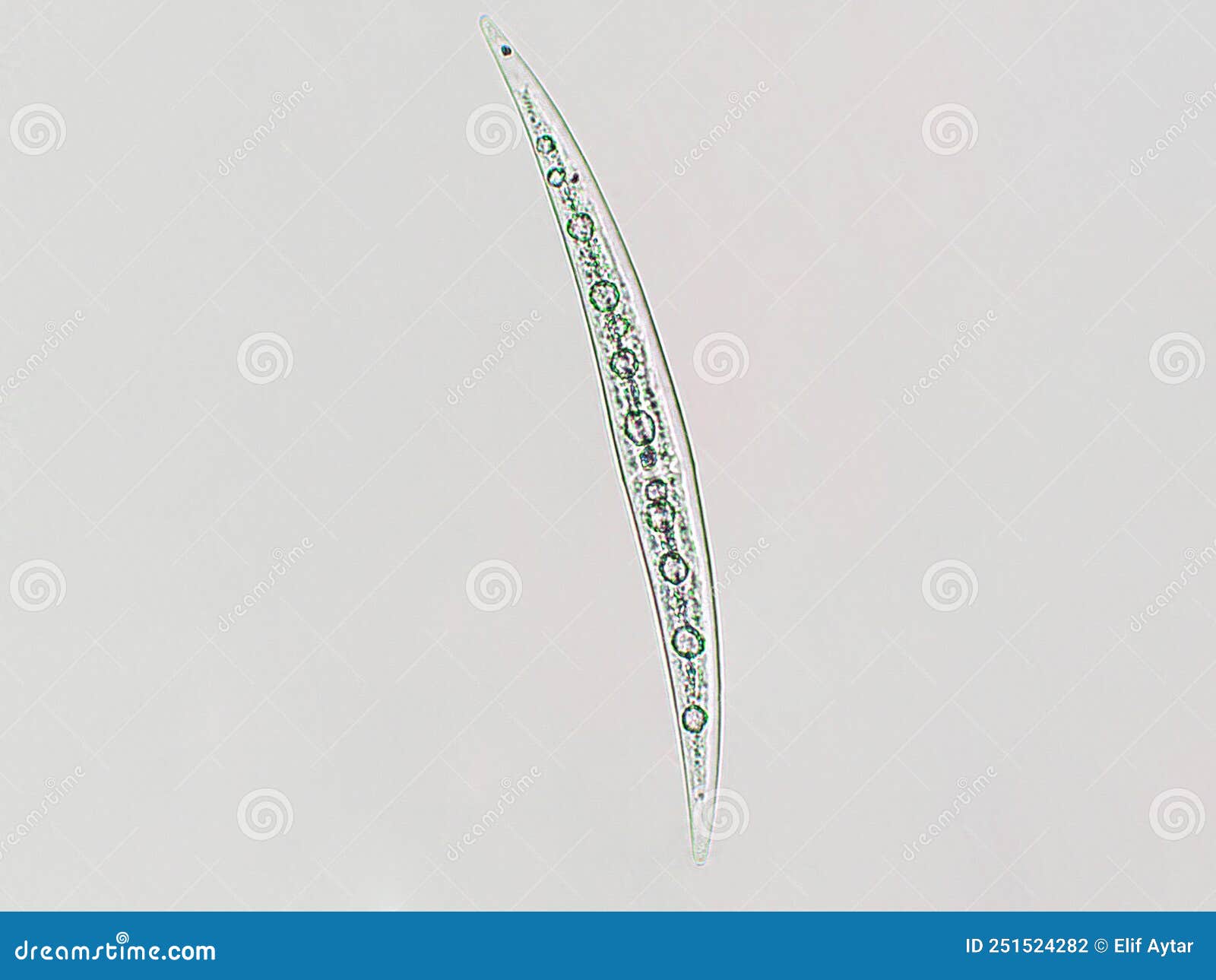 Closterium Sp. Algues Charophyta Sous Vue Microscopique X40 Algues ...