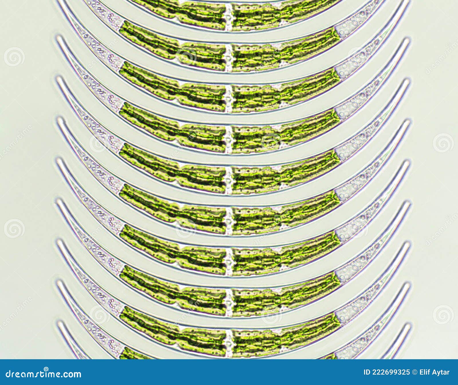 Closterium Sp. - Charophyta Algae Under Microscopic View X40, Green ...