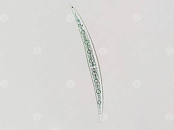 Closterium Sp. Charophyta Algae Under Microscopic View X40, Green Algae ...