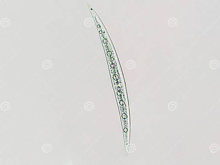 Closterium Sp. Charophyta Algae Under Microscopic View X40, Green Algae ...