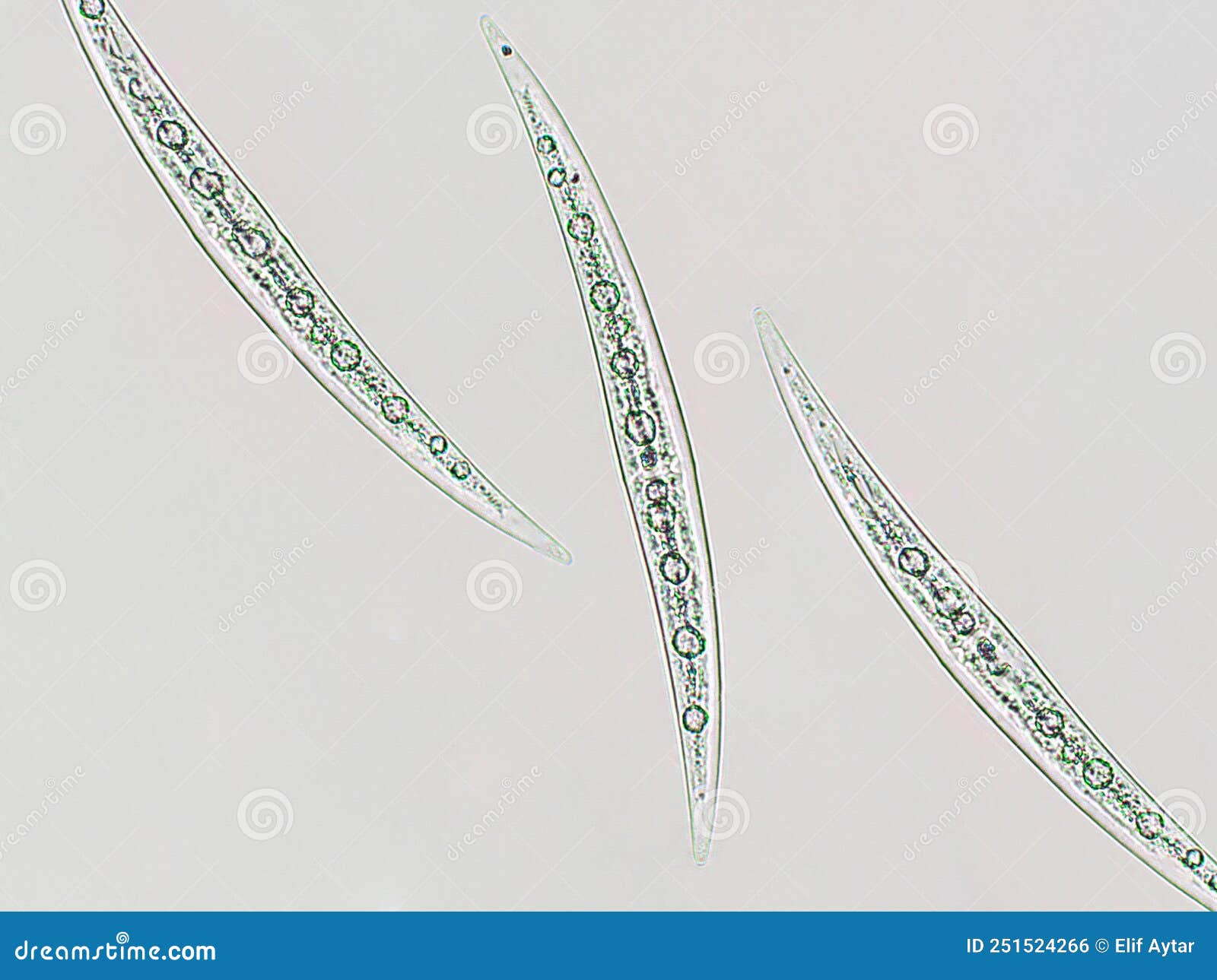 Freshwater Closterium Unicellular Charophyte Green Algae Closteriaceae ...