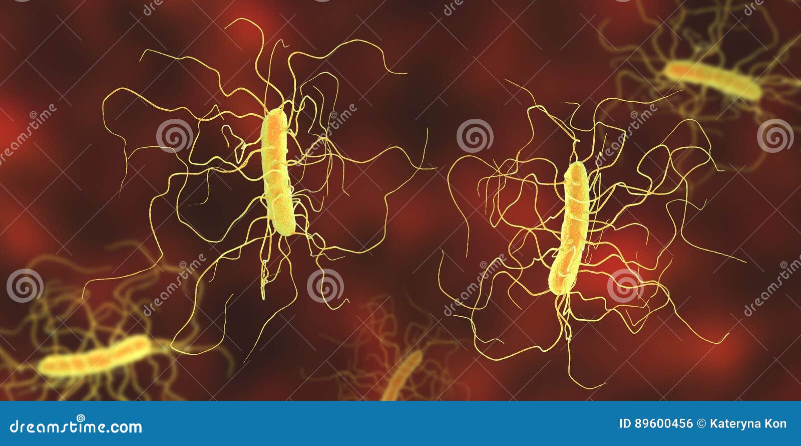 Clostridium Difficile Spore Stain