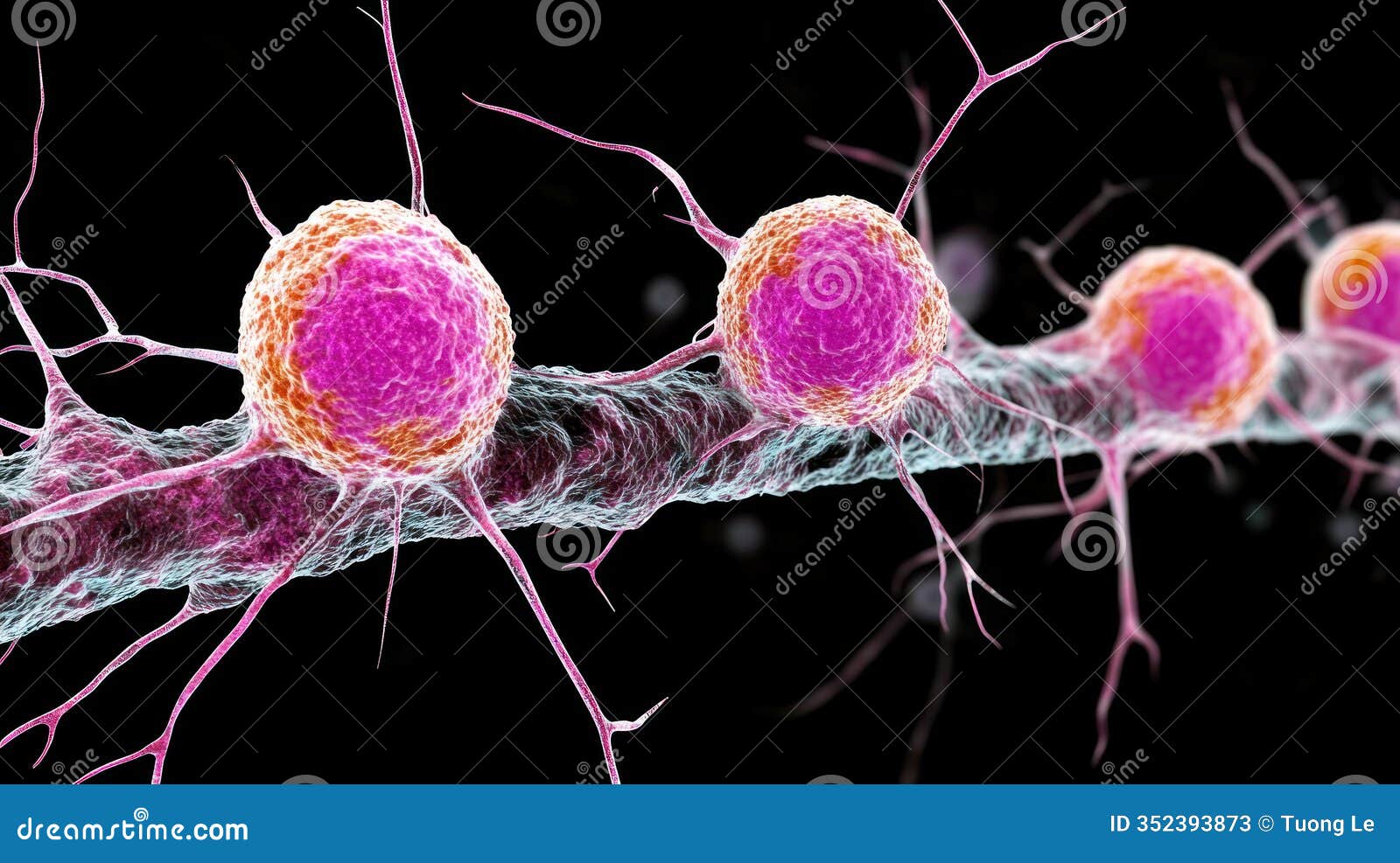 Cluster of Cancer Cells Under Microscope Stock Illustration ...