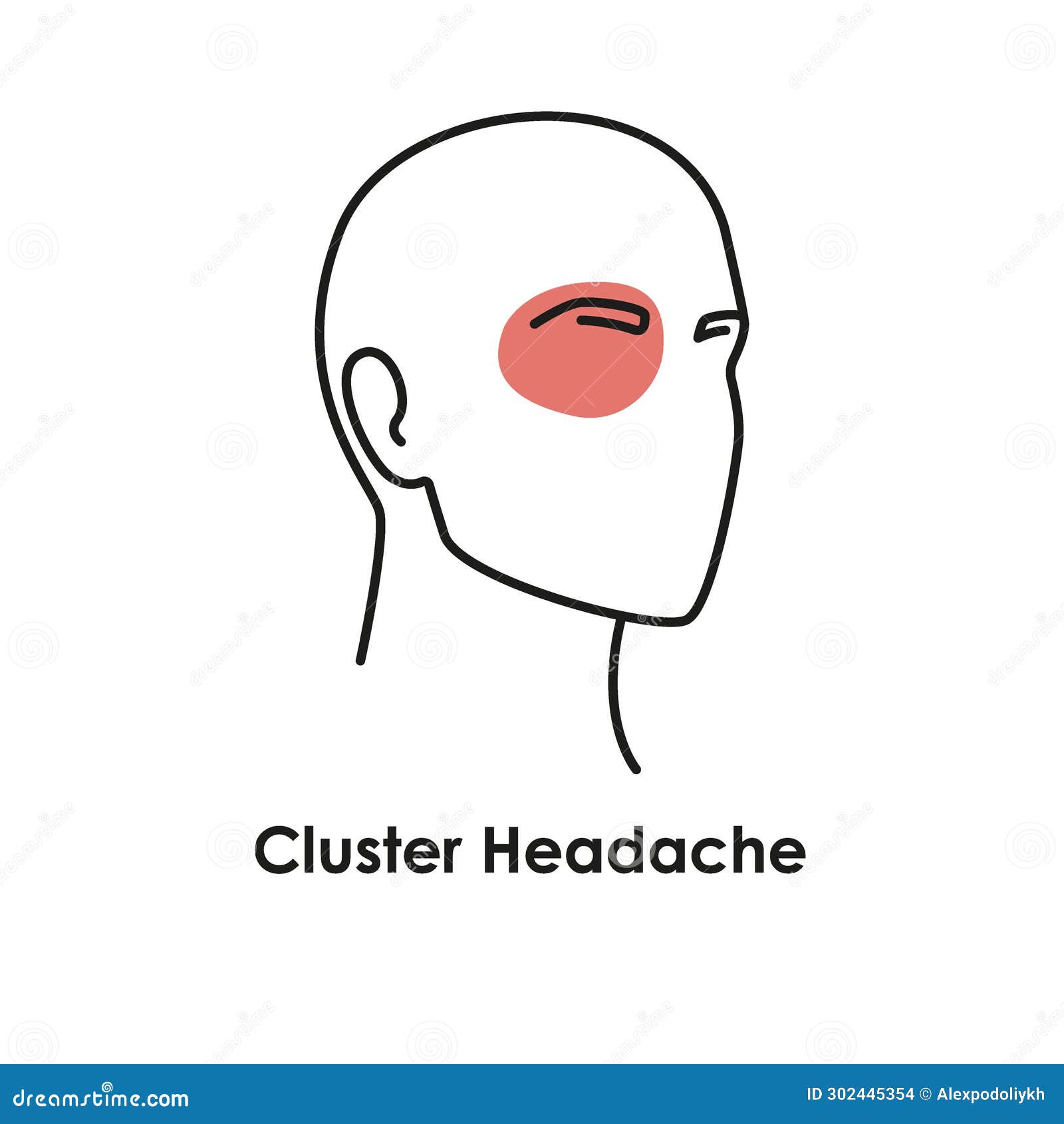 Cluster Headache Color Icon. Vector Isolated Illustration Stock Vector ...